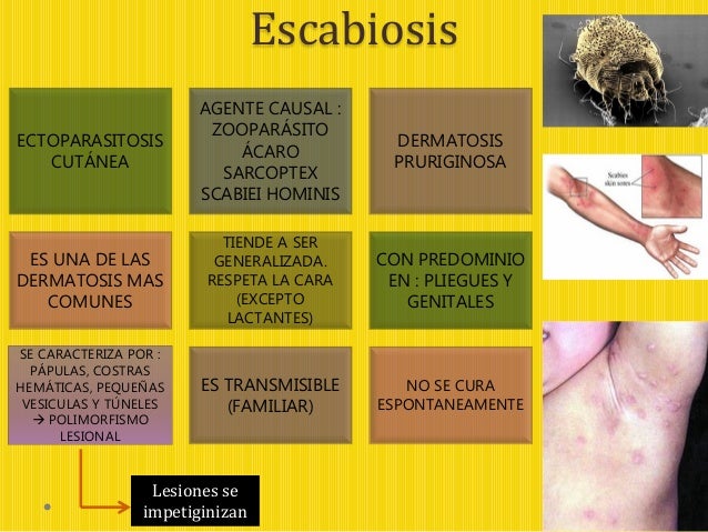Escabiasis