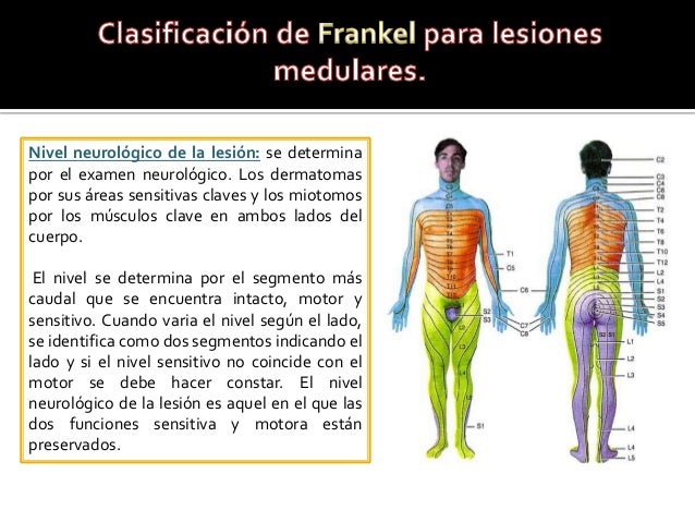 Cuadro De Escala De Franqueo Real