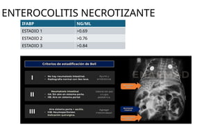 ESCALAS Y CLASIFICACIONES PEDIATRIA PARA EL ENARM | PPTX