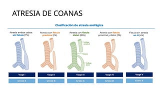 ESCALAS Y CLASIFICACIONES PEDIATRIA PARA EL ENARM | PPTX