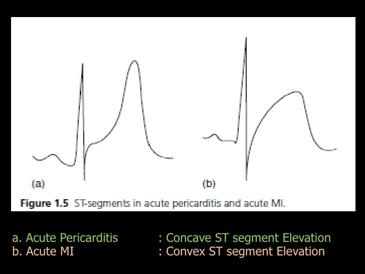Escaping from Emergency department pitfalls