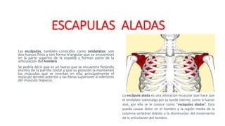 DEFINICIÓN DE LAS ESCAPULAS ALADAS EN LA FISIOTERAPIA | PPTX