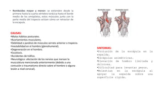 DEFINICIÓN DE LAS ESCAPULAS ALADAS EN LA FISIOTERAPIA | PPTX