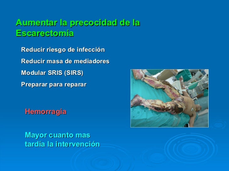 EscarectomíA En Quemado Grave. 2009