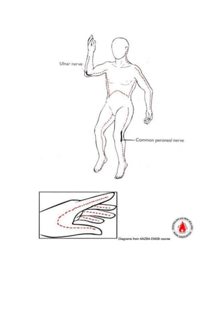 Escarotomy, Escarectomy, Burn , combustio | DOCX