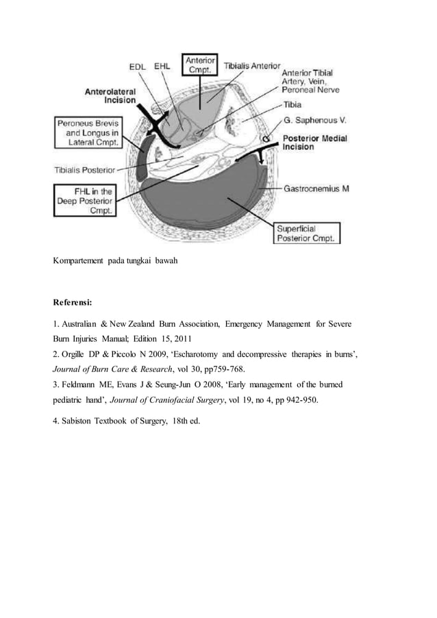 Escarotomy, Escarectomy, Burn , combustio | PDF