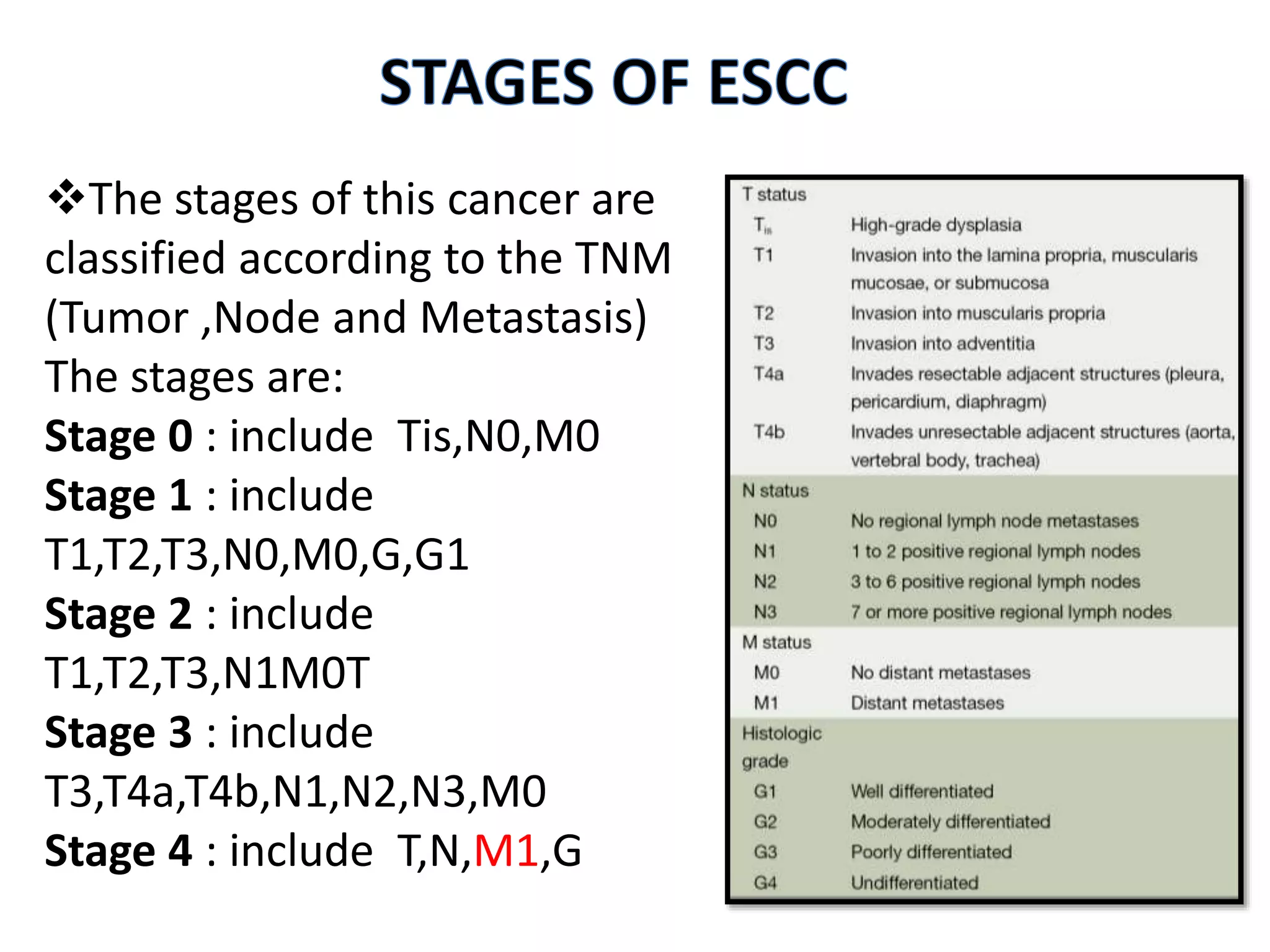 Escc esophageal squamous cell carcinoma | PPTX