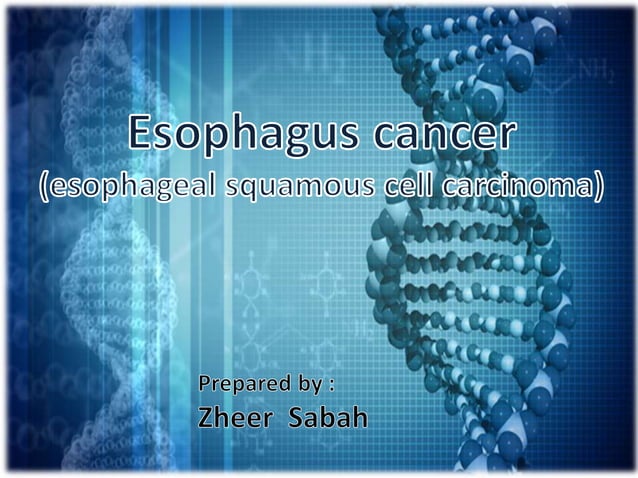 Escc esophageal squamous cell carcinoma | PPTX