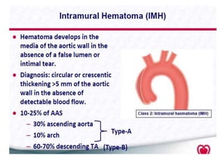 2014 ESC guidelines aortic diseases | PPT