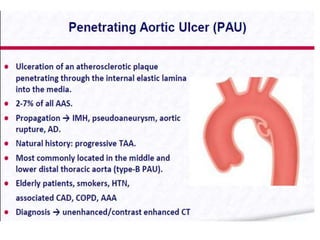 2014 ESC guidelines aortic diseases | PPT