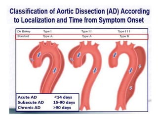 2014 ESC guidelines aortic diseases | PPT