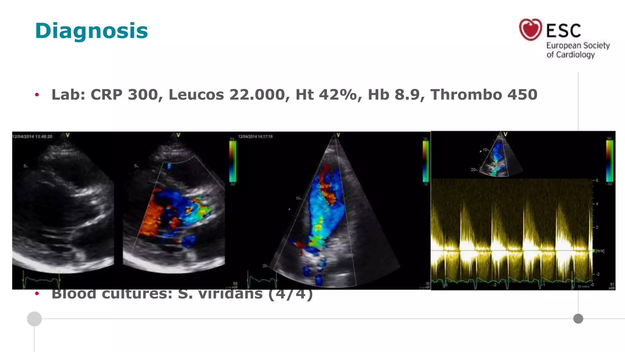 Esc guidelines endocarditis by prof deldago | PPTX