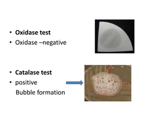 Escherichia coli lecture | PPTX