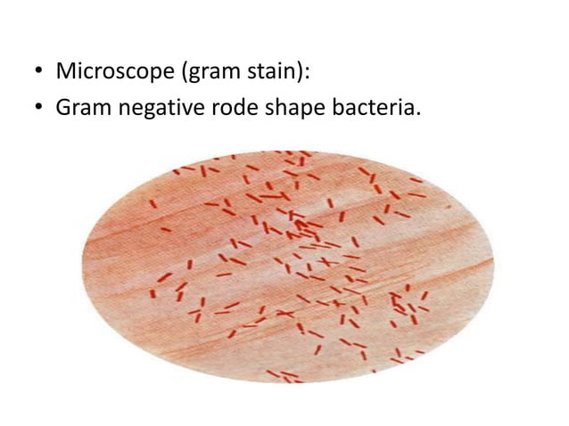 Escherichia coli lecture | PPTX
