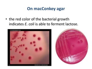 Escherichia coli lecture | PPTX
