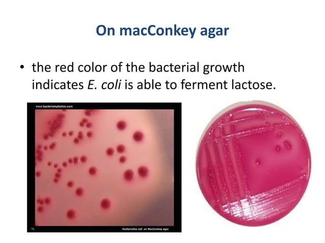Escherichia coli lecture | PPTX