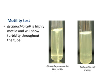 Escherichia coli lecture | PPT