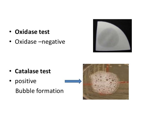Escherichia coli lecture