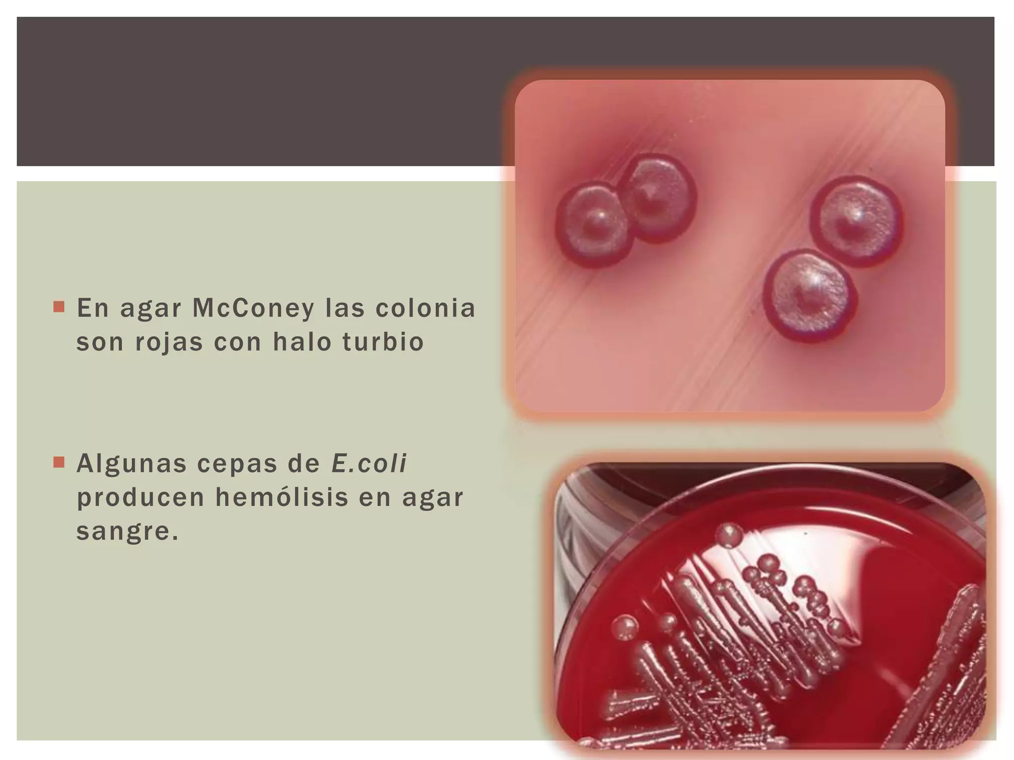 Escherichia coli | PPTX