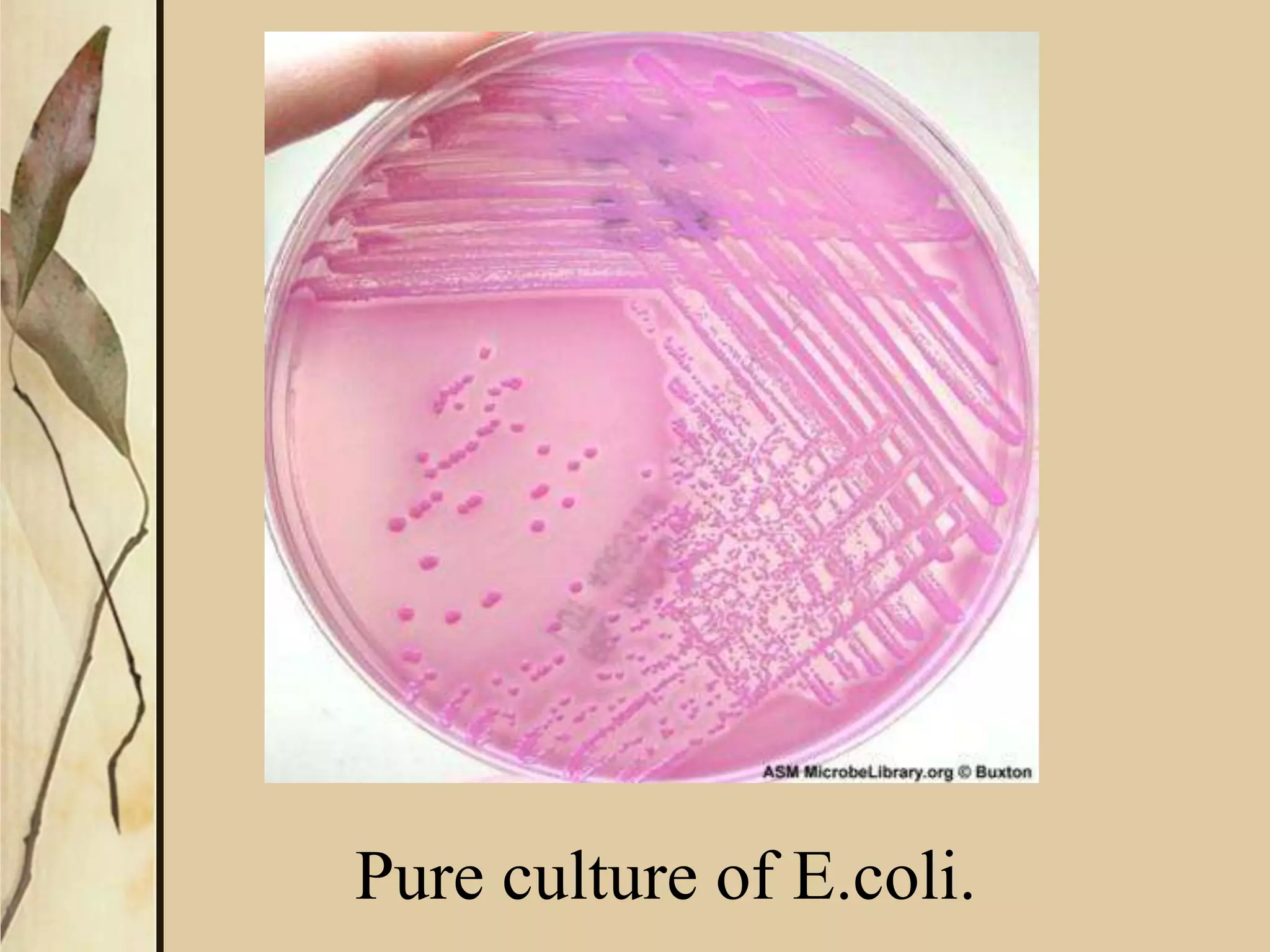 Escherichia coli | PPTX