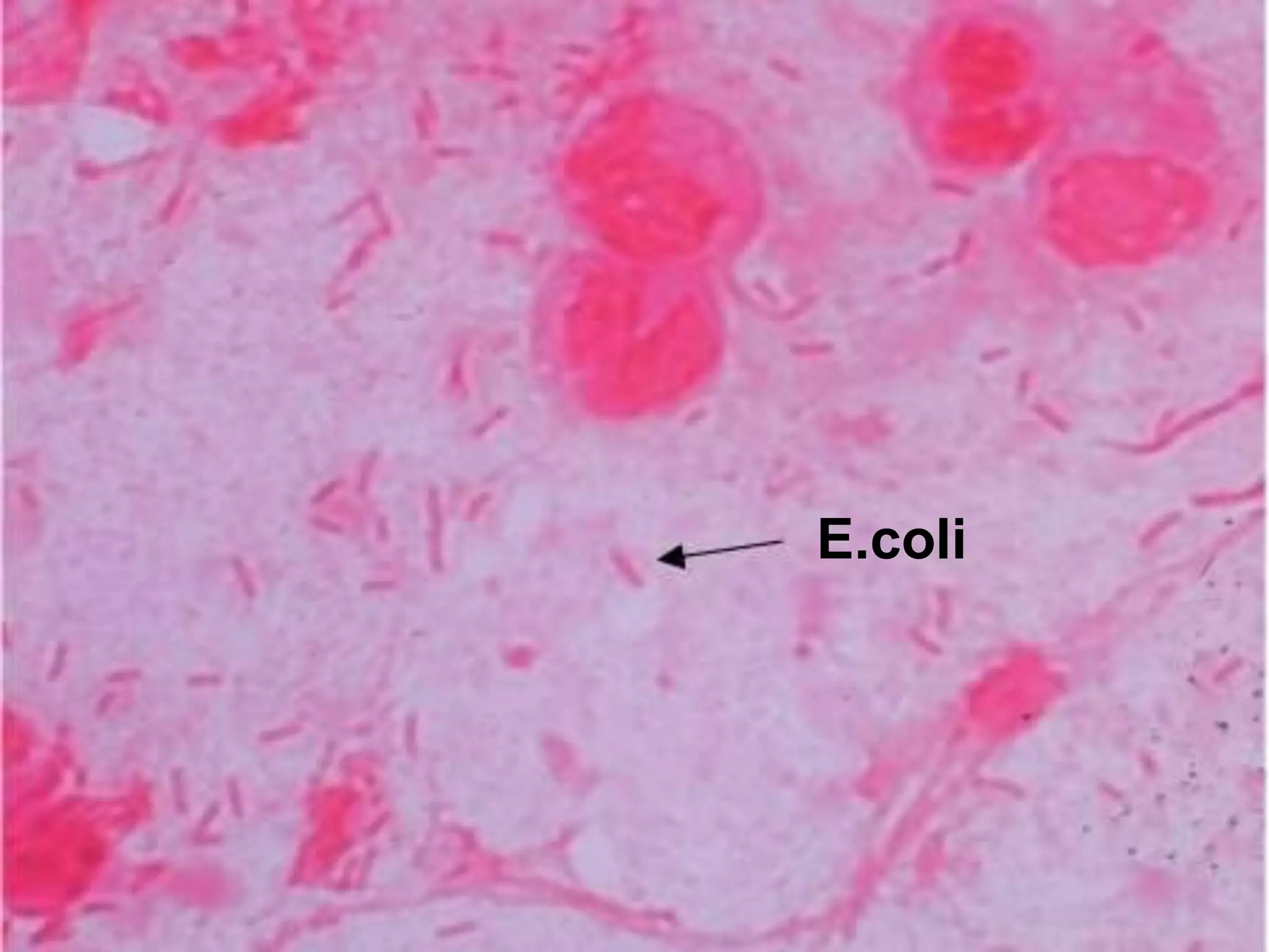 Escherichia coli | PPTX
