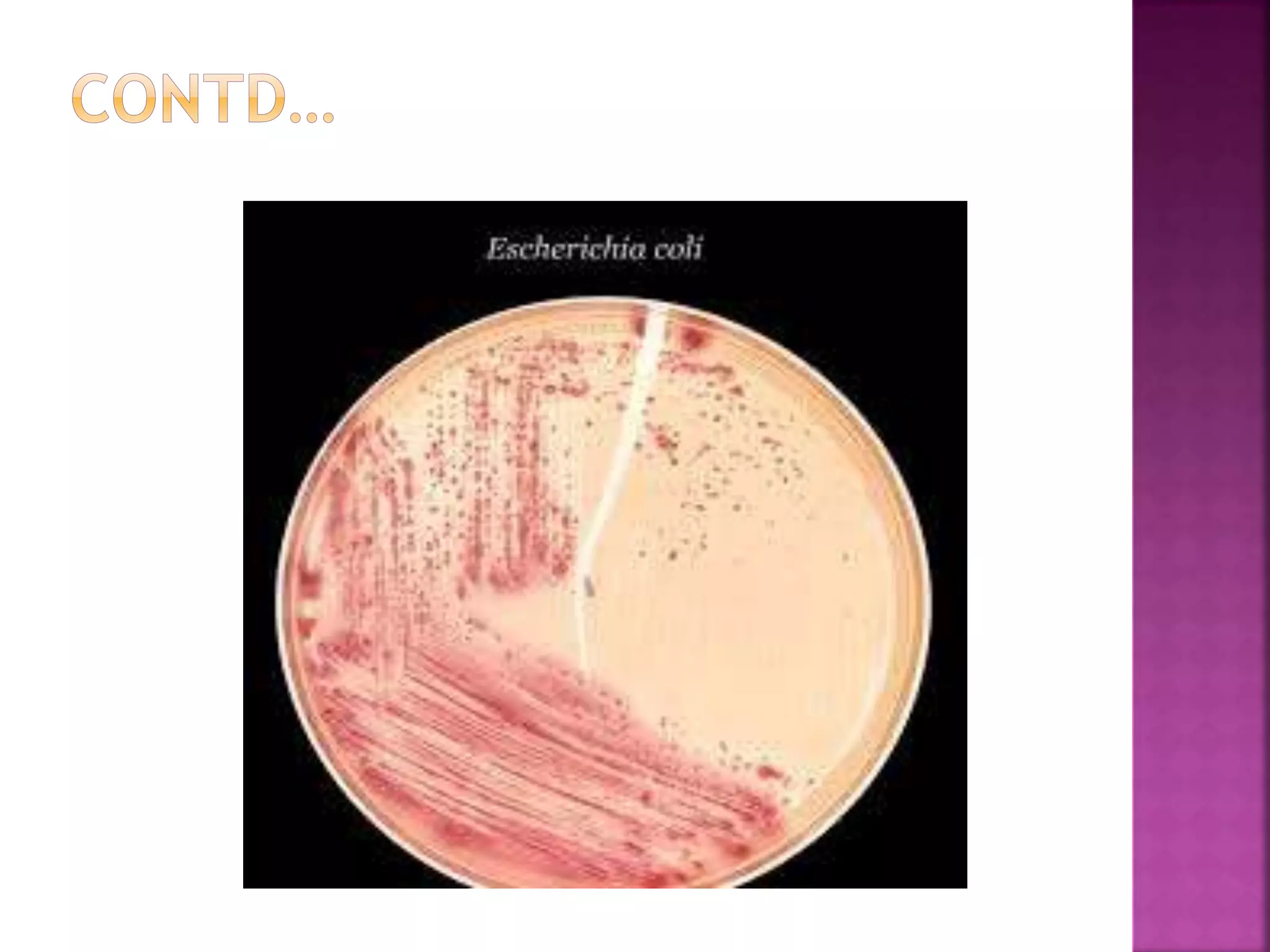 Escherichia coli | PPTX