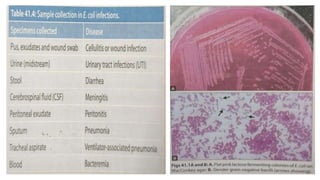Escherichia coli | PPT