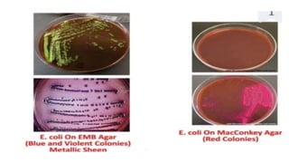 ESCHERICHIA COLI.pptx