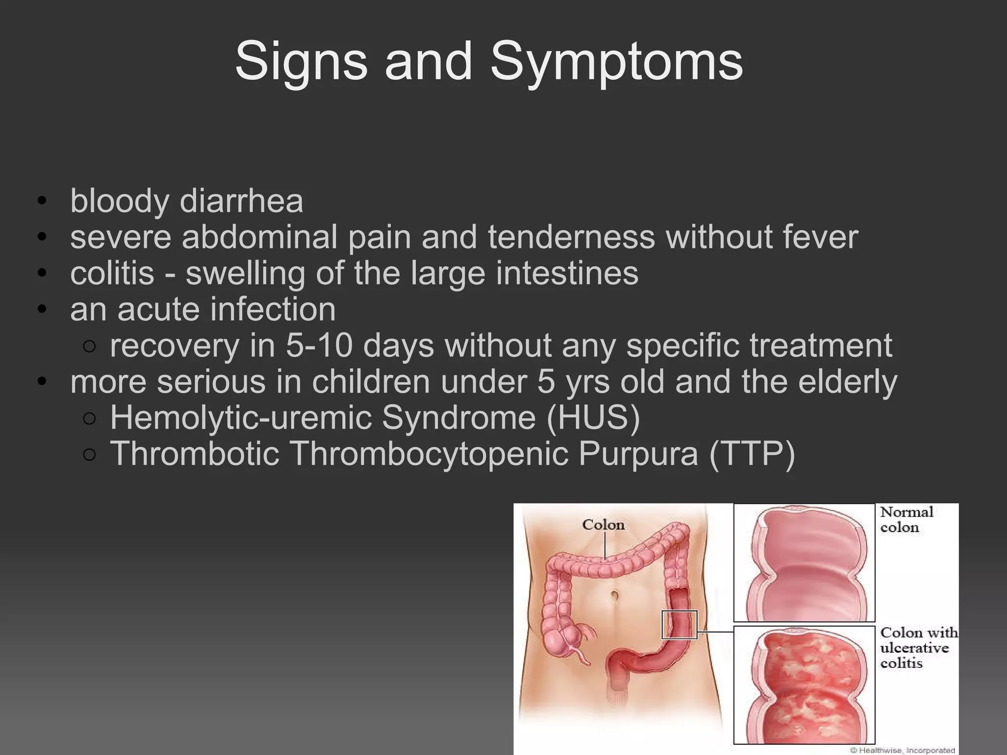 Escherichia Coli 0157 H7 | PPT