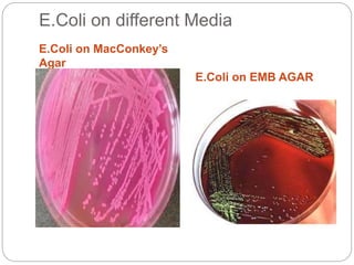 Escherichia coli (e.c oli) | PPTX