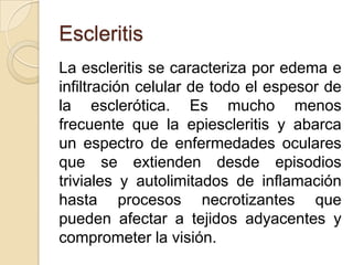 Escleritis | PPTX