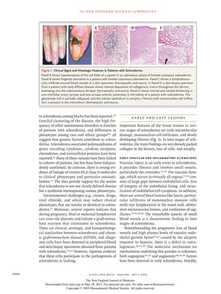 Esclerodermia | PDF | Skin and Dermatology | Diseases and Conditions