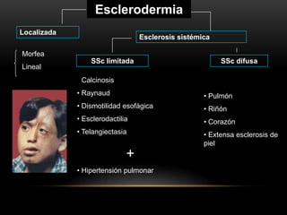 Esclerodermia | PPTX