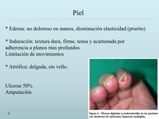 Esclerodermia | PPTX
