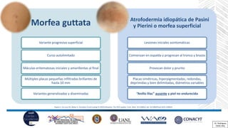 Sesión Académica del CRAIC "Esclerodermia localizada y Dermatomiositis ...