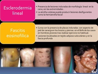 Esclerodermia o esclerosis sistemica | PPTX