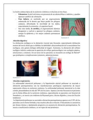 Esclerodermia trabajo.docx y reumatologi | DOCX