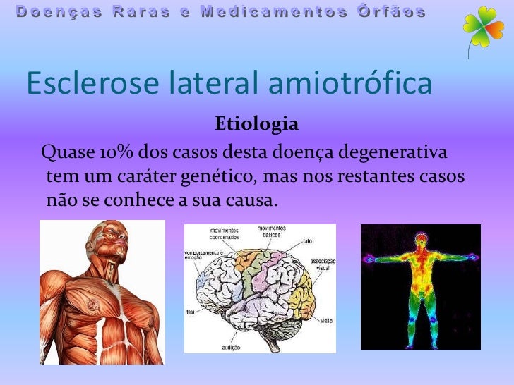 Esclerose Lateral Amiotrófica : Conheça A Doença – RJUOJI
