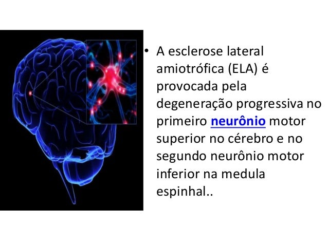 Esclerose Lateral Amiotrófica : Conheça A Doença – RJUOJI