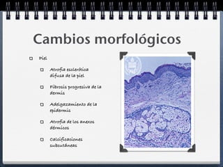 Esclerosis Sistémica | KEY