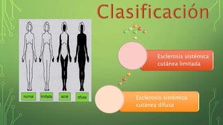 Esclerosis sistémica y síndromes esclerodermiformes | PPTX