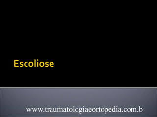 Escoliose | PPT