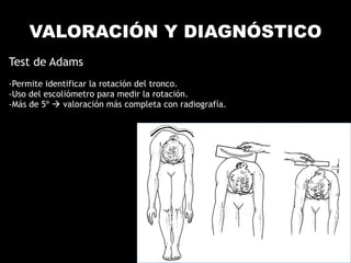 Escoliosis | PDF