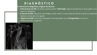 ESCOLIOSIs y su tratamiento medico y qxx | PDF