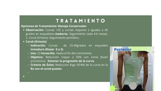 ESCOLIOSIs y su tratamiento medico y qxx | PDF