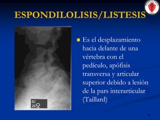 Escoliosis, espondilolistesis.ppt