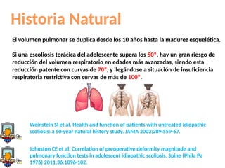 Tipos de corsé en la escoliosis idiopática del adolescente | PPTX