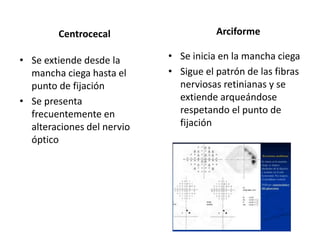 escotomas.pptx