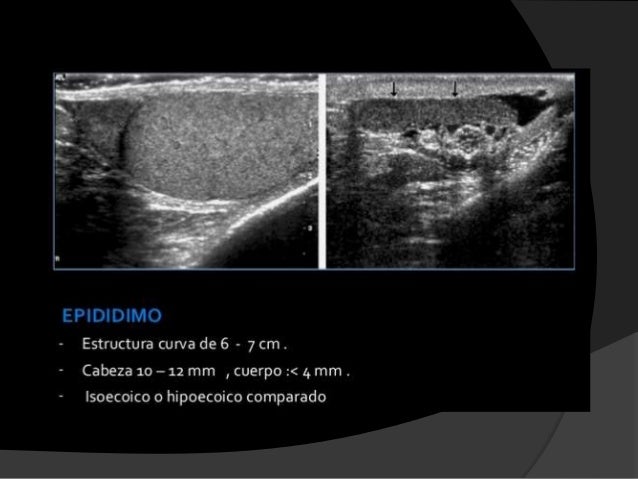 Enfermedades En El Escroto Imagen