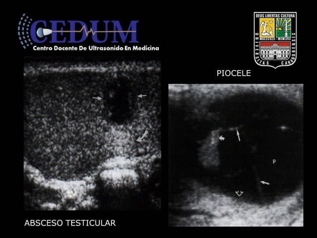 ecografia de escroto y sus patologias.pdf | Descarga Gratuita